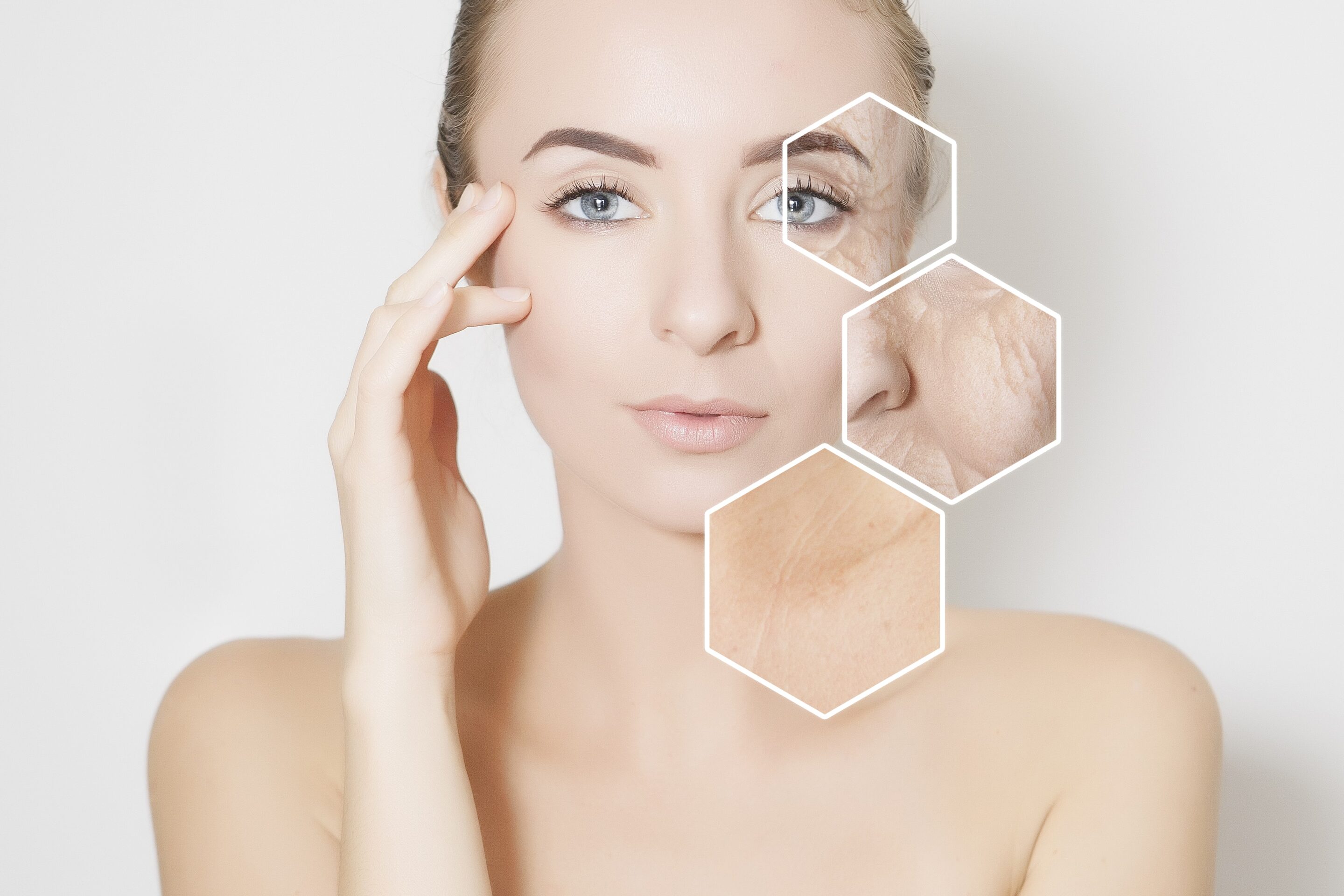 Fractora: Total Skin Restoration | Parfaire Medical Aesthetics