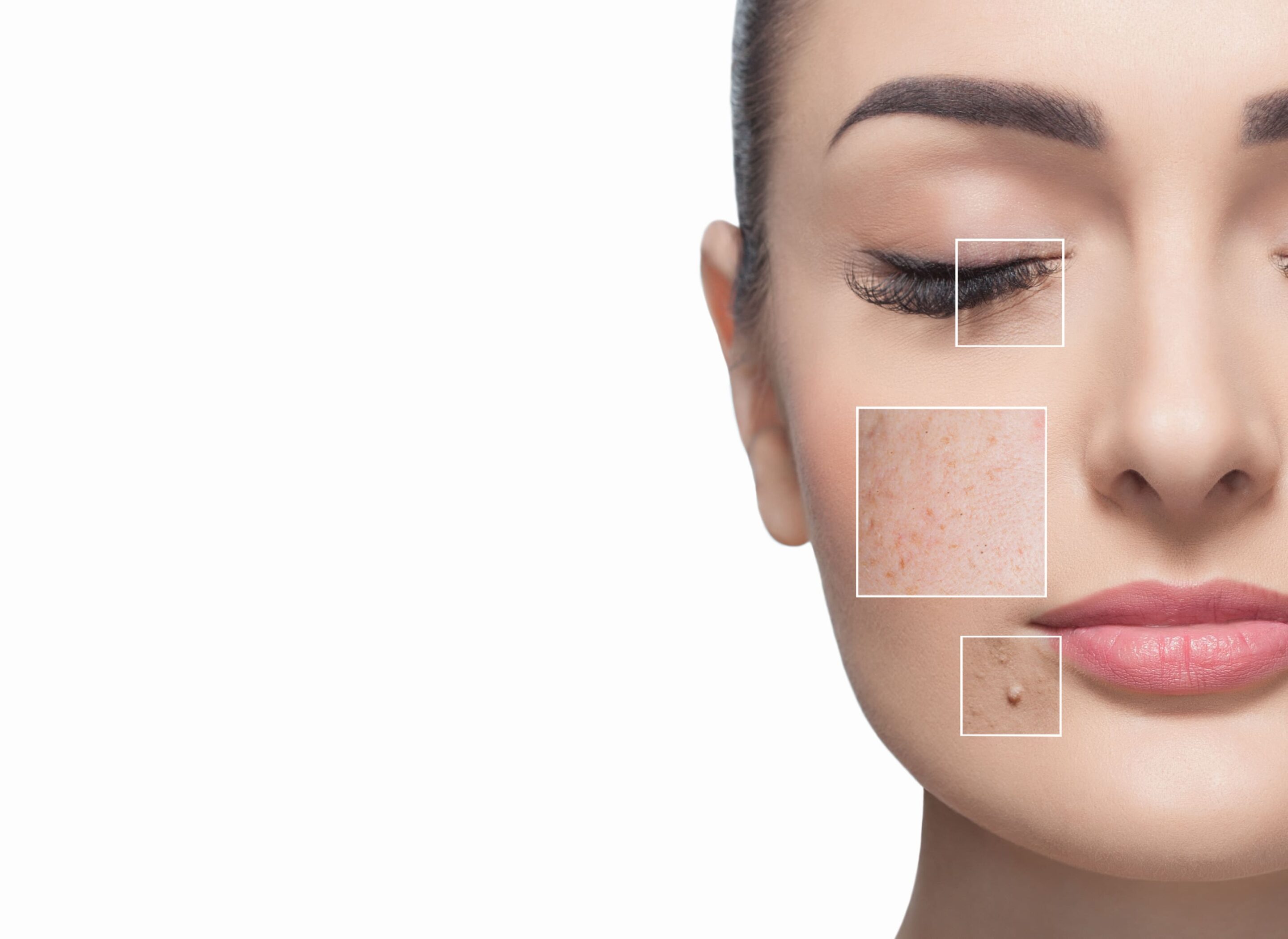 Treat Dark Spots on Your Skin - Parfaire