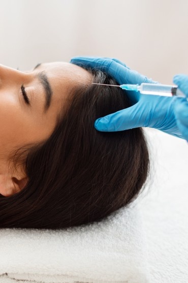Top Benefits of PRP for Hair Loss Treatment | Parfaire
